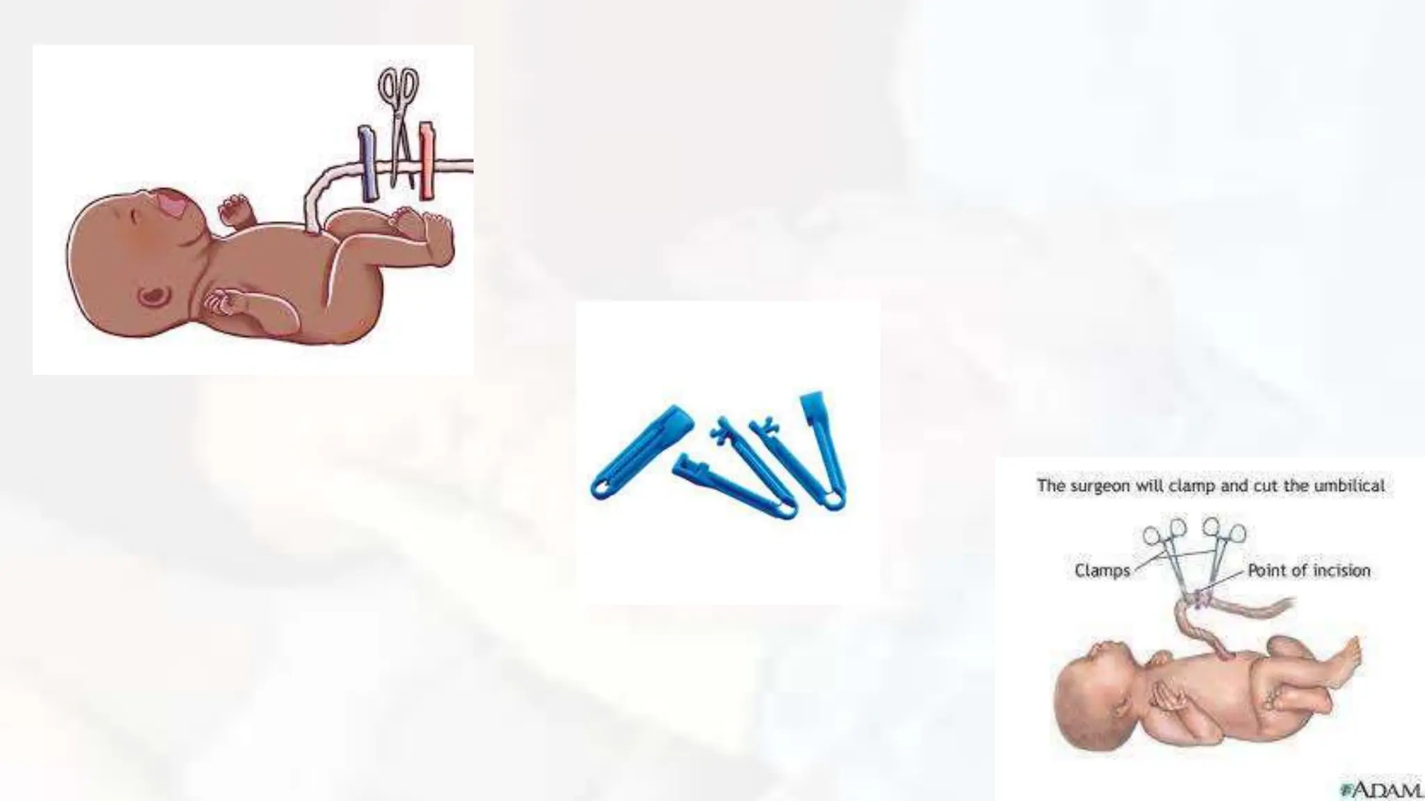 Unit III, Nursing care of a neonate PART 1.pptx