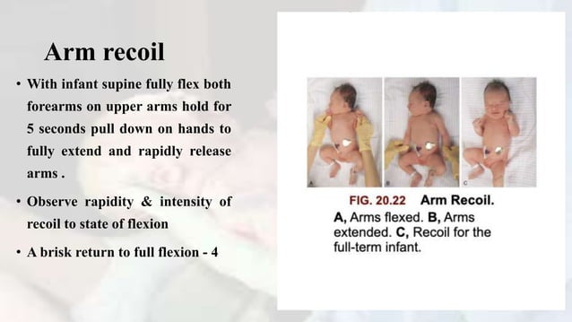 Unit III, Nursing care of a neonate PART 1.pptx | Pregnancy ...