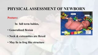 Unit III, Nursing care of a neonate PART 1.pptx