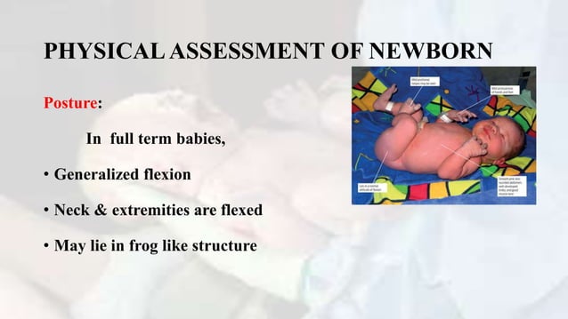 Unit III, Nursing care of a neonate PART 1.pptx | Pregnancy ...