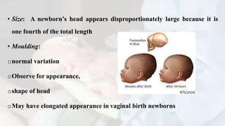 Unit III, Nursing care of a neonate PART 1.pptx