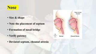 Unit III, Nursing care of a neonate PART 1.pptx