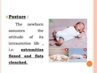 Unit 3 nsg.care of neonate | PPTX