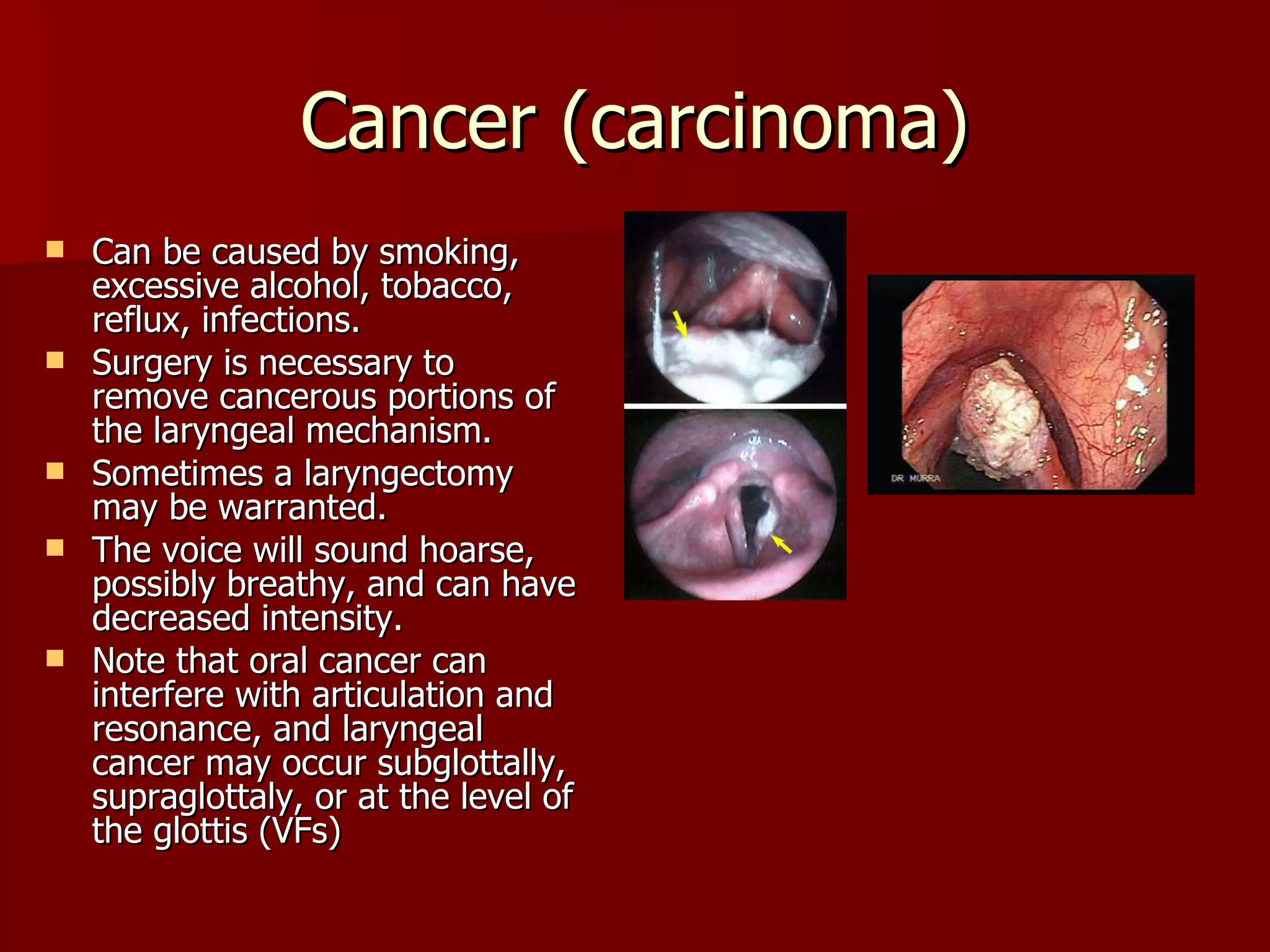 Unit 3: Organic Voice Disorders | PPT