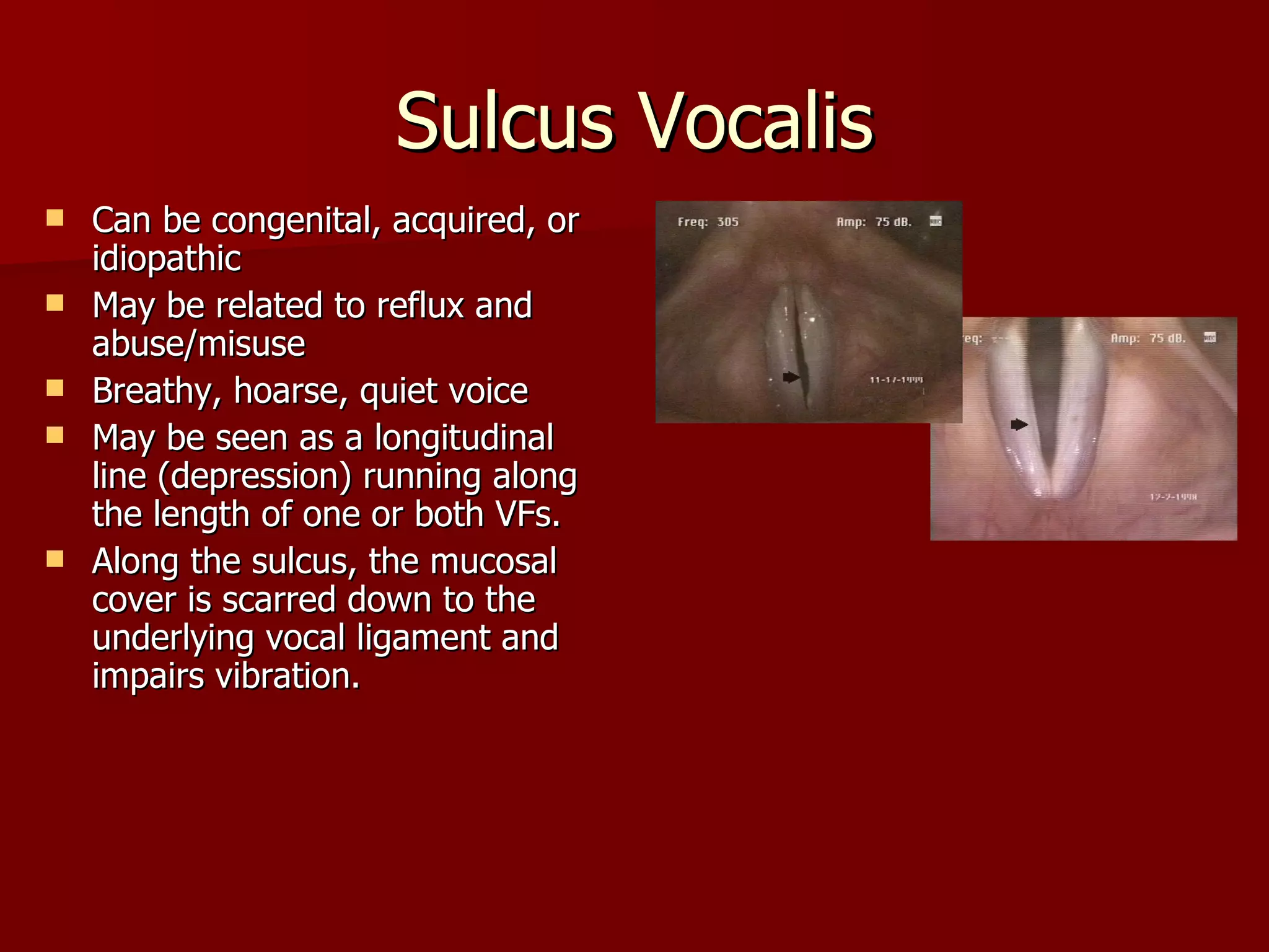 Unit 3: Organic Voice Disorders | PPT
