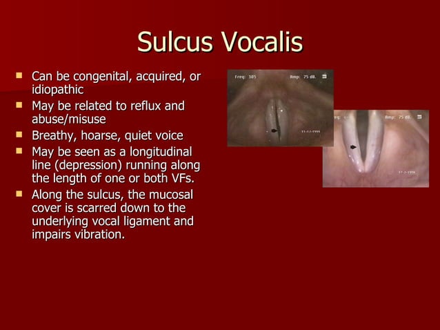 Unit 3: Organic Voice Disorders | PPT
