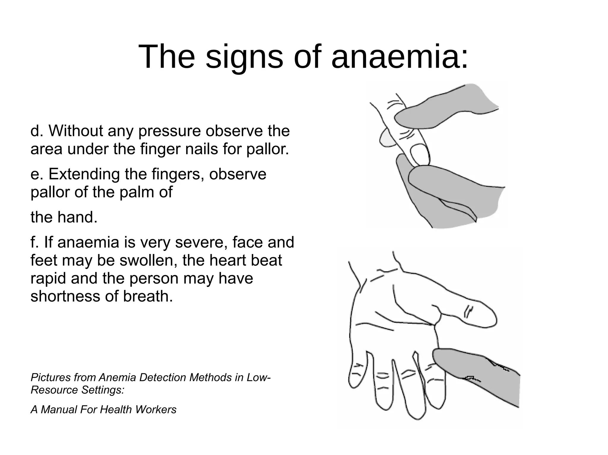 Unit 3 rbc disorders | ODP