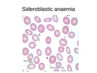 Unit 3 rbc disorders | ODP