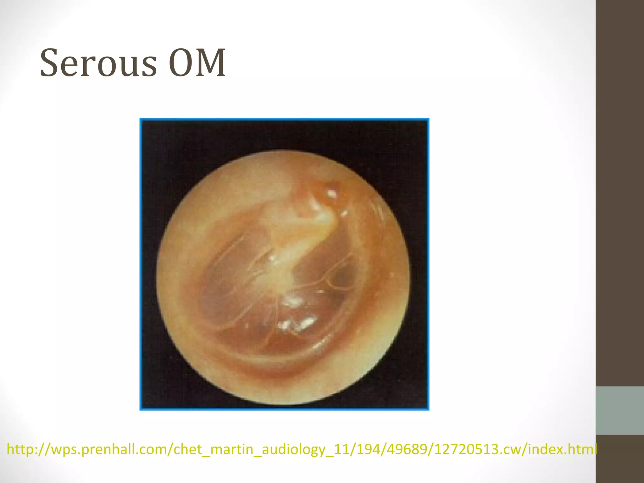 Medical Imaging, Otitis Media, & Otosclerosis | PPT