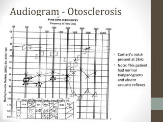 Medical Imaging, Otitis Media, & Otosclerosis | PPT