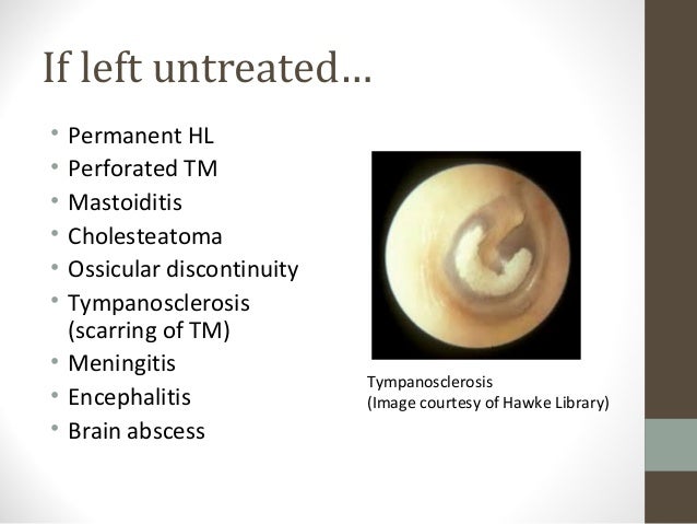 Medical Imaging, Otitis Media, & Otosclerosis