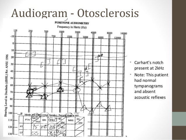 Medical Imaging, Otitis Media, & Otosclerosis