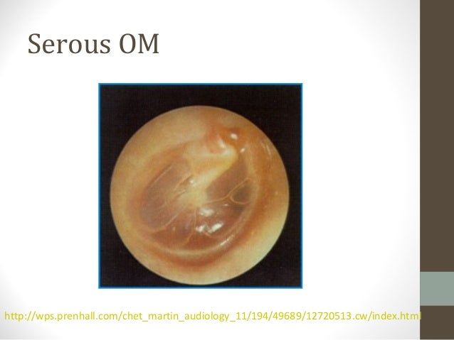 Medical Imaging, Otitis Media, & Otosclerosis