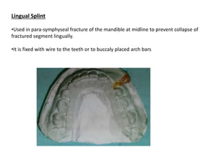 Unit 3 Splints.pptx