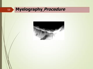 Special Radiographic procedure of spinal cord | PPTX