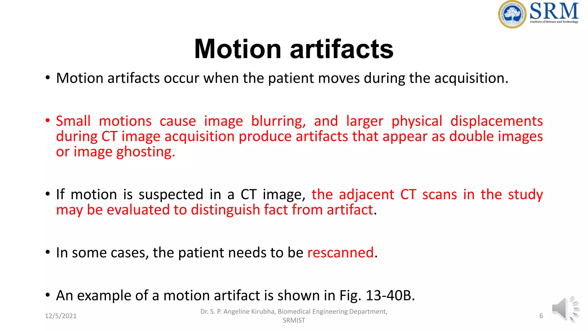 Noise and artifacts in CT | PPTX