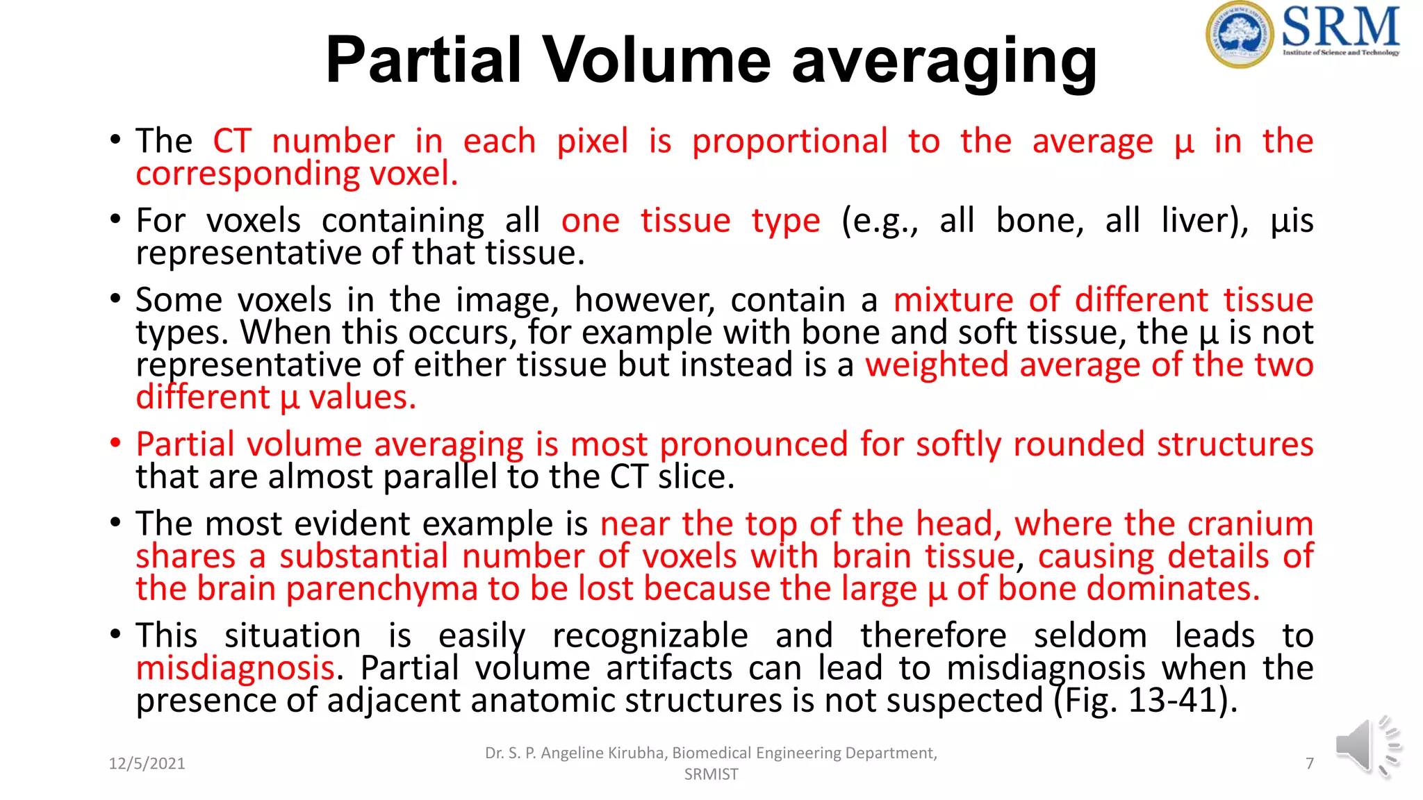 Noise and artifacts in CT | PPTX