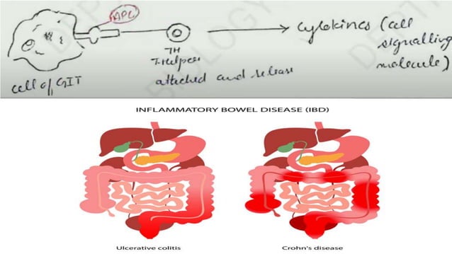 unit4 IBD PPT BKG.pptx Pathophysiology B.pharma 2nd sem | PPT