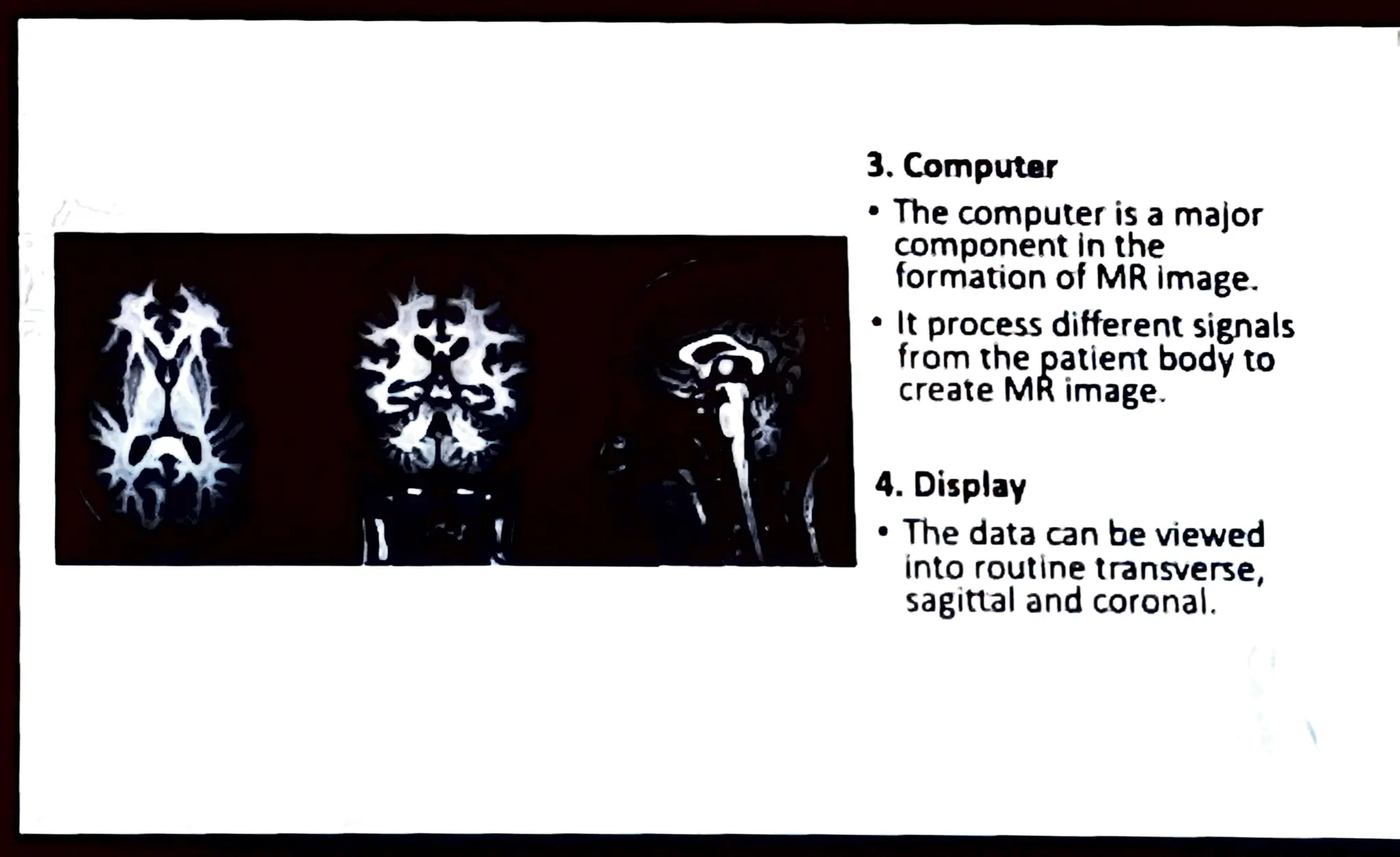 MRI.pdf