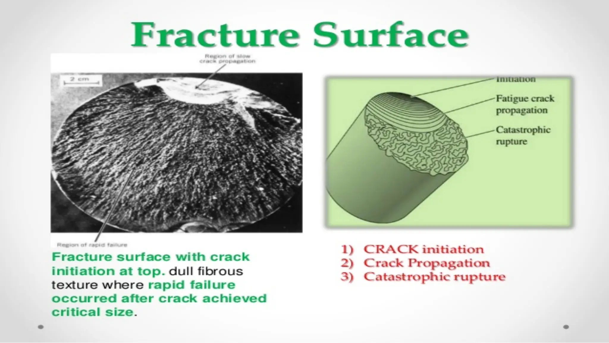 Types of fractures -At a glance with few case studies | PDF