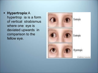 Unit 4; Special Senses, Educational Platform.pptx