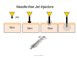 Unit 4 transdermal drug delivary system .pptx