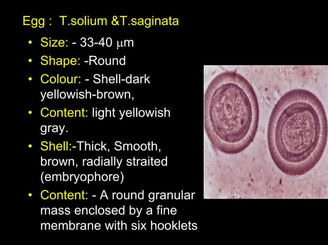 u,d,ds,.s,d.s,.d,çwleç,,d,nit 5. Tapeworms.ppt