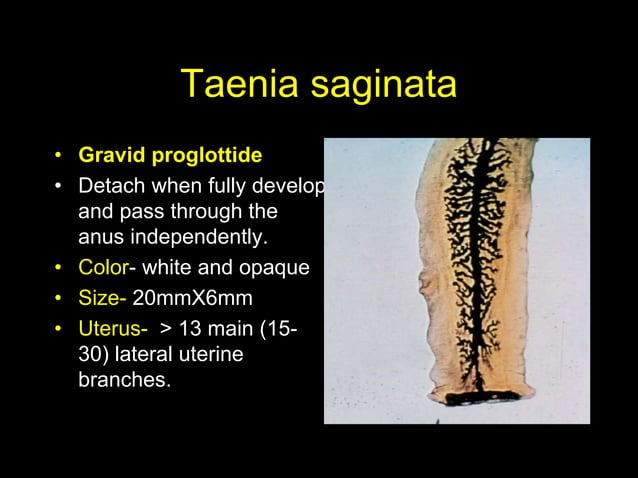 u,d,ds,.s,d.s,.d,çwleç,,d,nit 5. Tapeworms.ppt