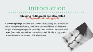 Comprehensive Guide to Bitewing X-Ray Procedure in Dentistry | PPTX