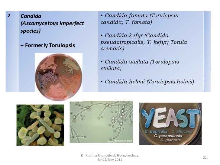 VTU 06BT74 Unit 5 Synopsis of microorganisms