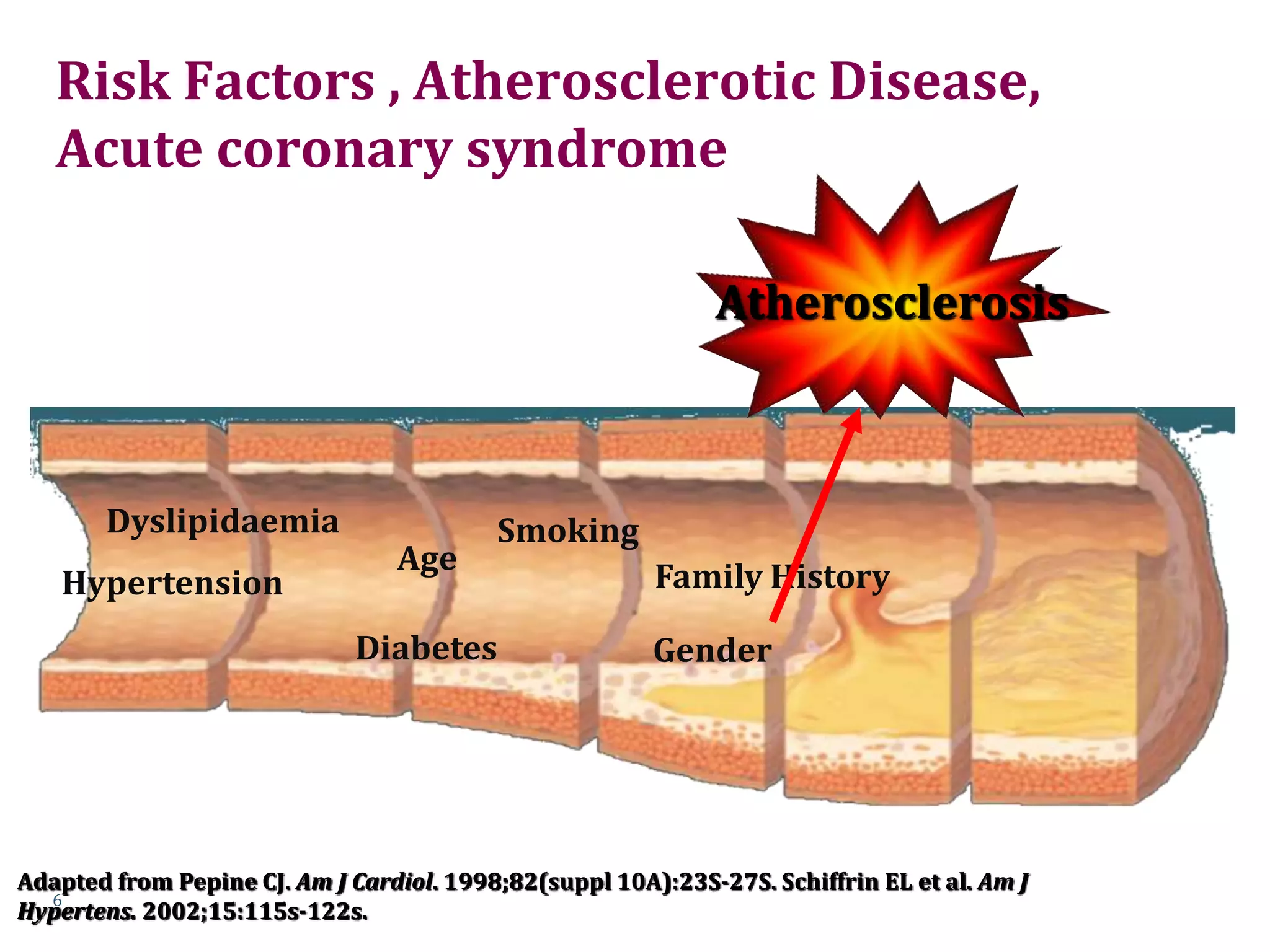Unit 5_Complications of HTN(2).pptx