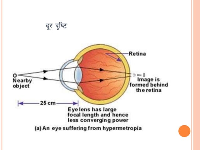 Science Unit 5 Defect of vision Nepali. | PPT