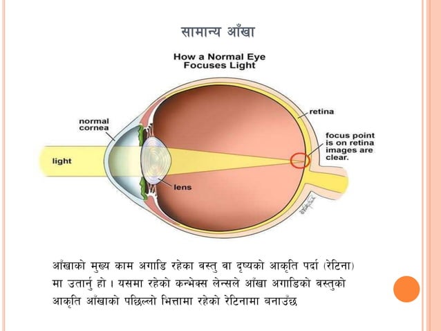 Science Unit 5 Defect of vision Nepali. | PPT