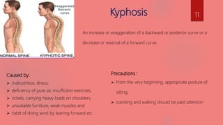 UNIT - 5 - POSTURES | PPTX