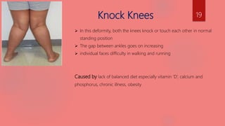 UNIT - 5 - POSTURES | PPTX