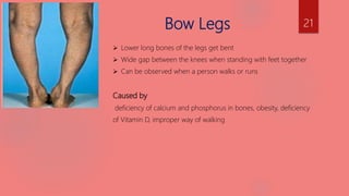 UNIT - 5 - POSTURES | PPTX