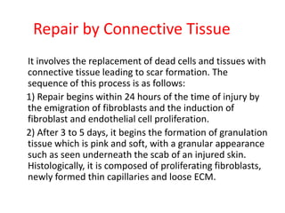 unit 5 Tissue Healing and Repair notes.ppt