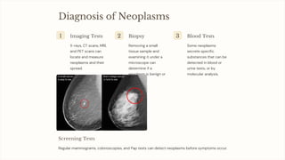 Neoplasia and cancer for pathology students | PDF