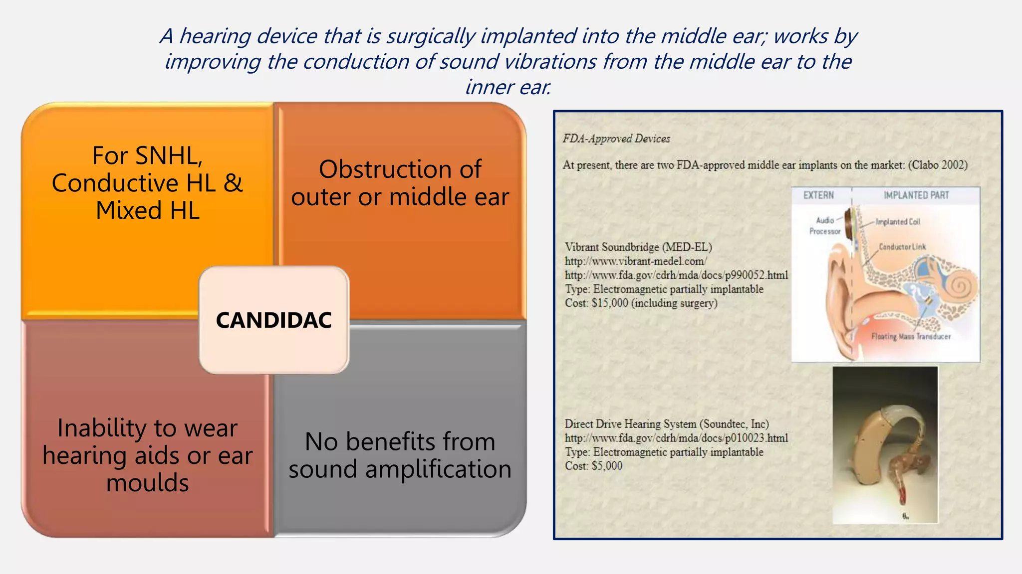 IMPLANTABLE HEARING DEVICES MASLP | PPTX