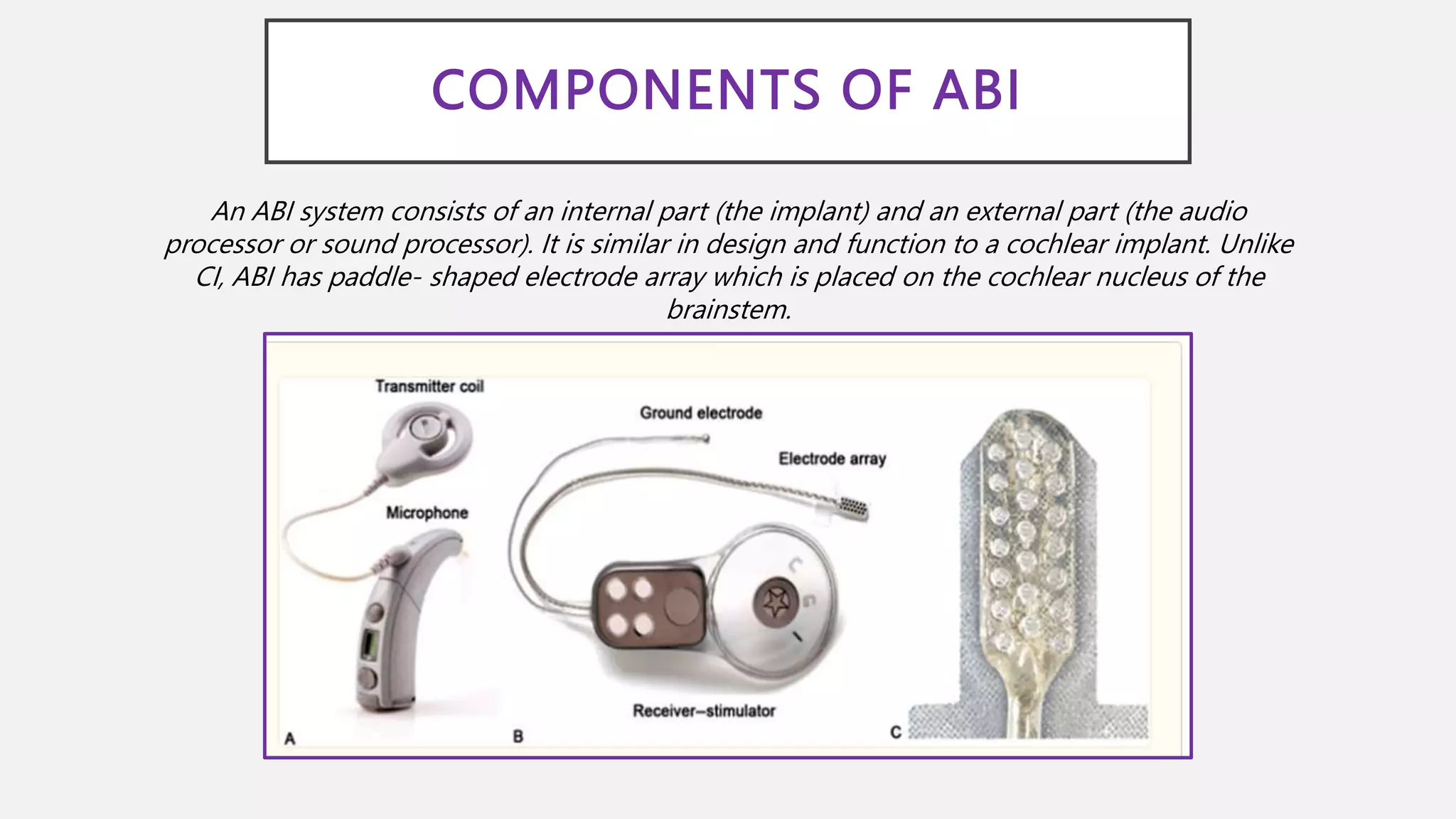IMPLANTABLE HEARING DEVICES MASLP | PPTX