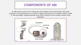 IMPLANTABLE HEARING DEVICES MASLP | PPTX