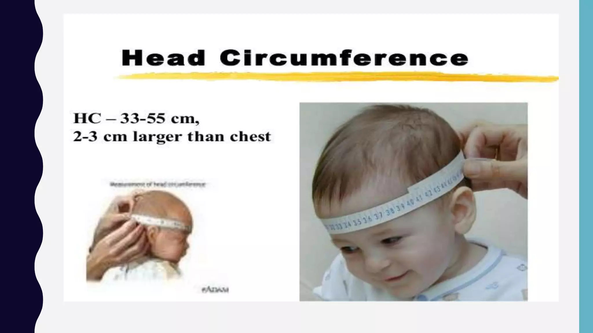 Normal Neonates | PPTX