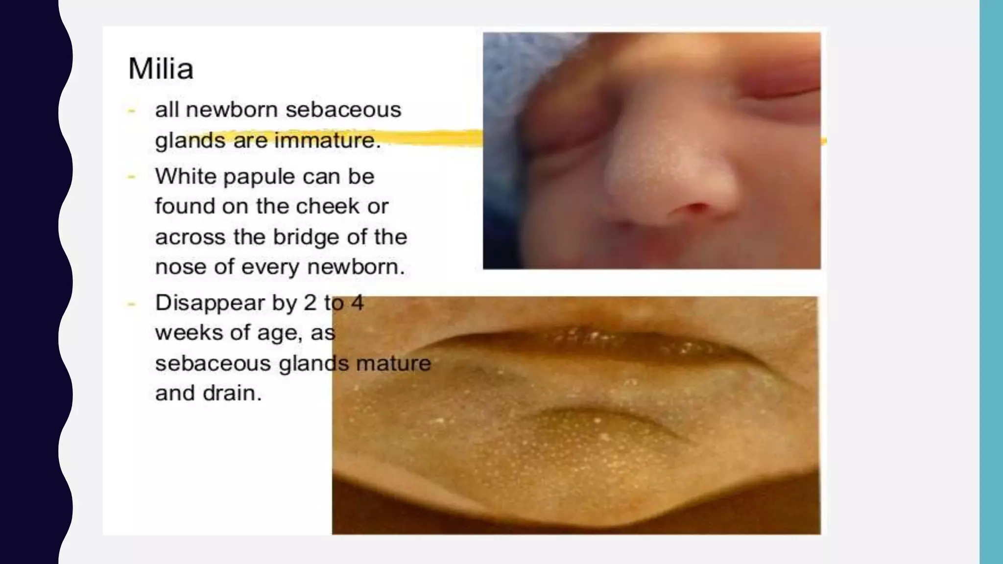 Normal Neonates | PPTX