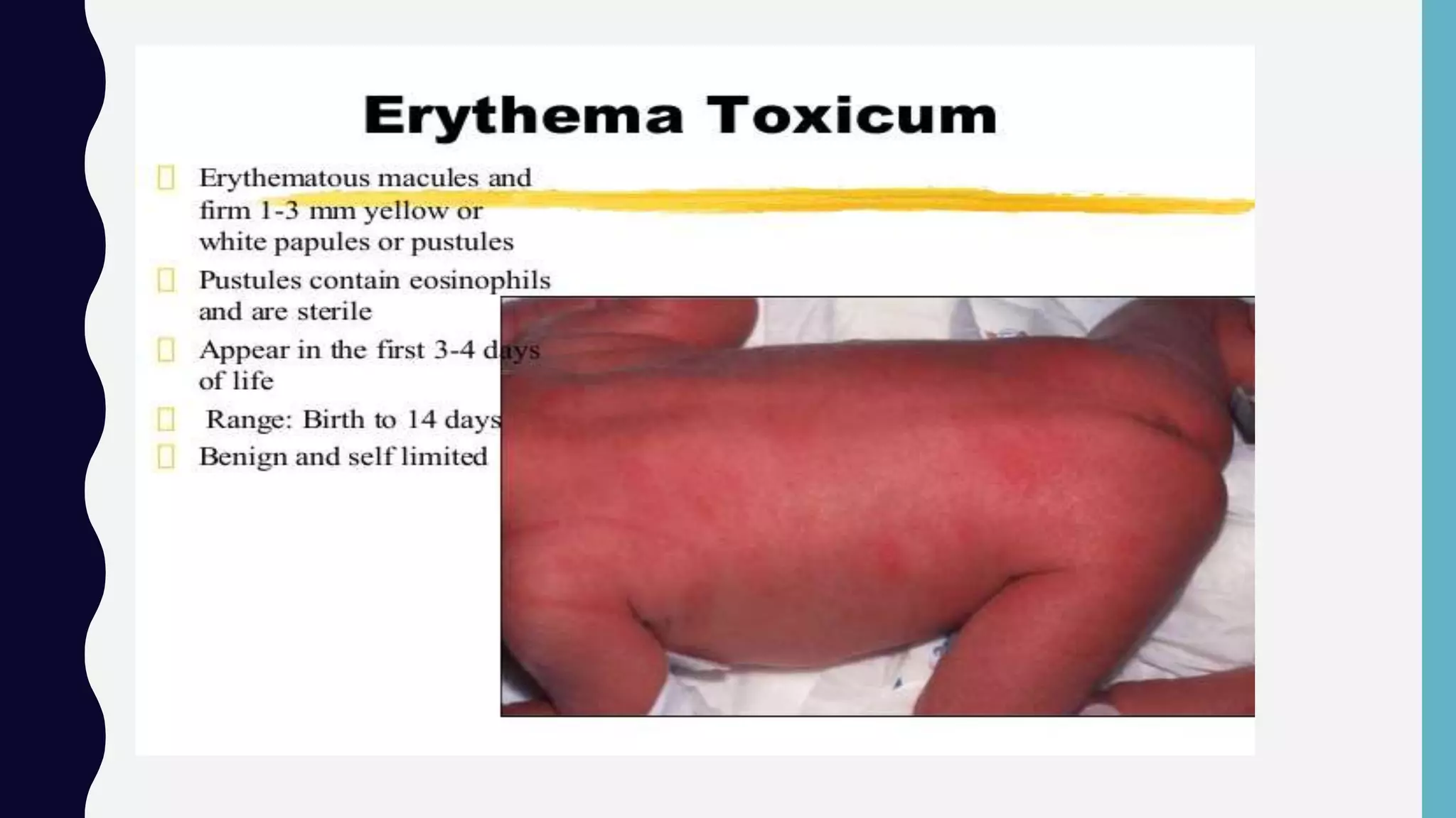 Normal Neonates | PPTX
