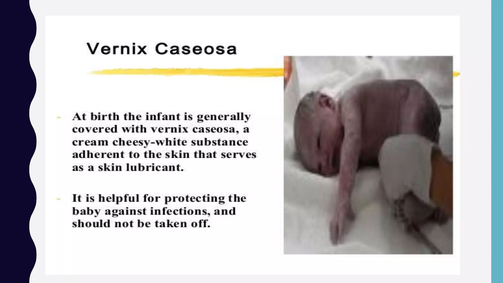Normal Neonates | PPTX