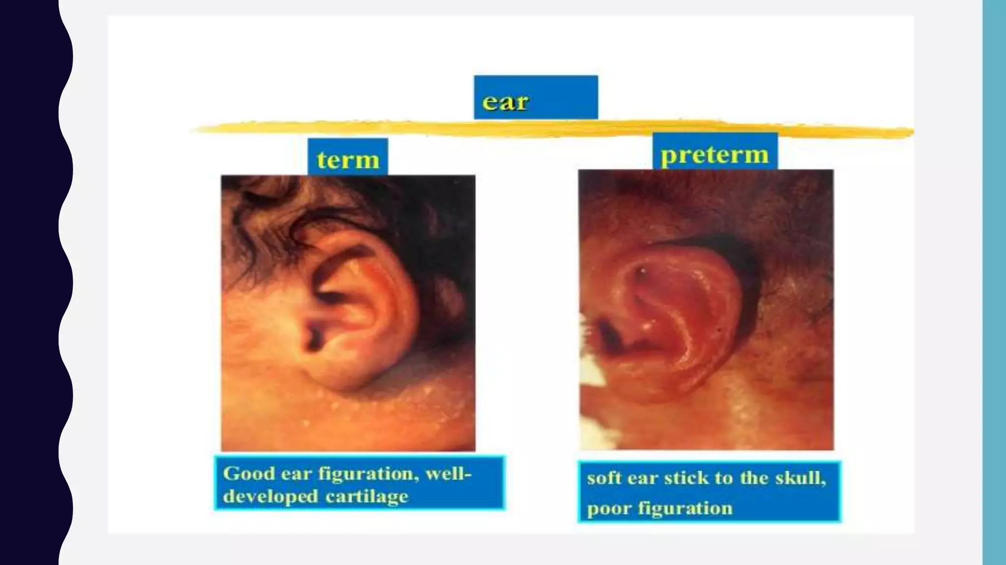 Normal Neonates | PPTX