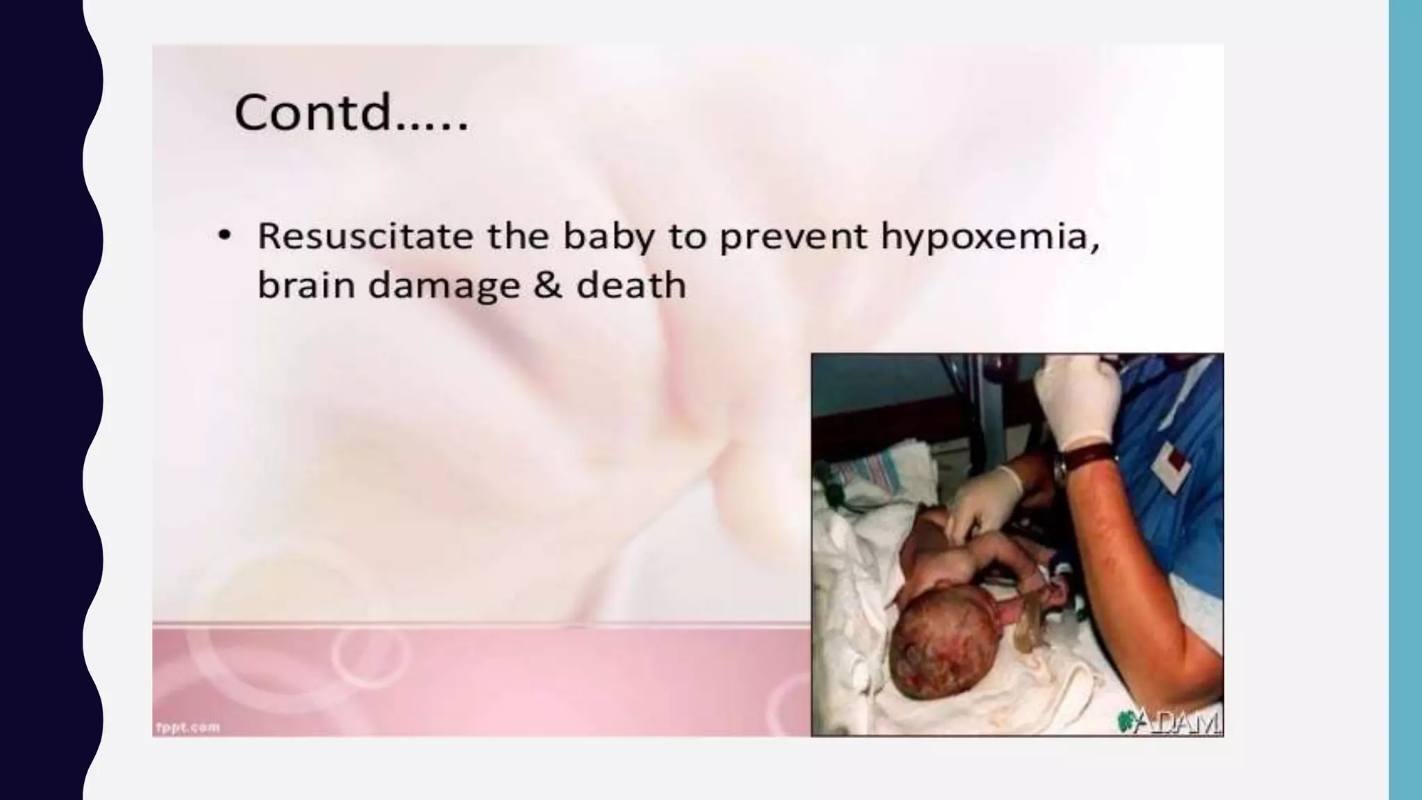 Normal Neonates | PPTX