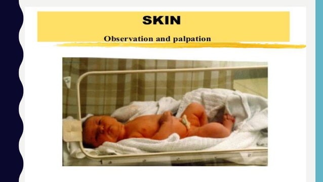 Normal Neonates | PPTX | Pregnancy | Reproductive Health