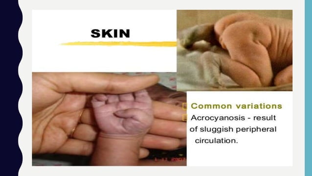 Normal Neonates | PPTX | Pregnancy | Reproductive Health