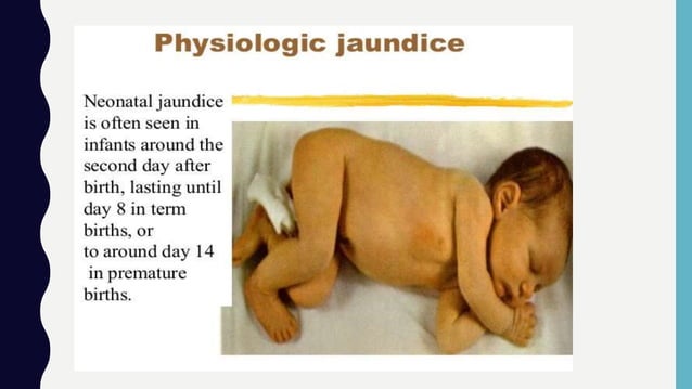 Normal Neonates | PPTX | Pregnancy | Reproductive Health